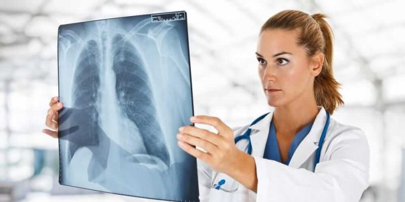 X-Ray Diagnostic - thaiswallowing